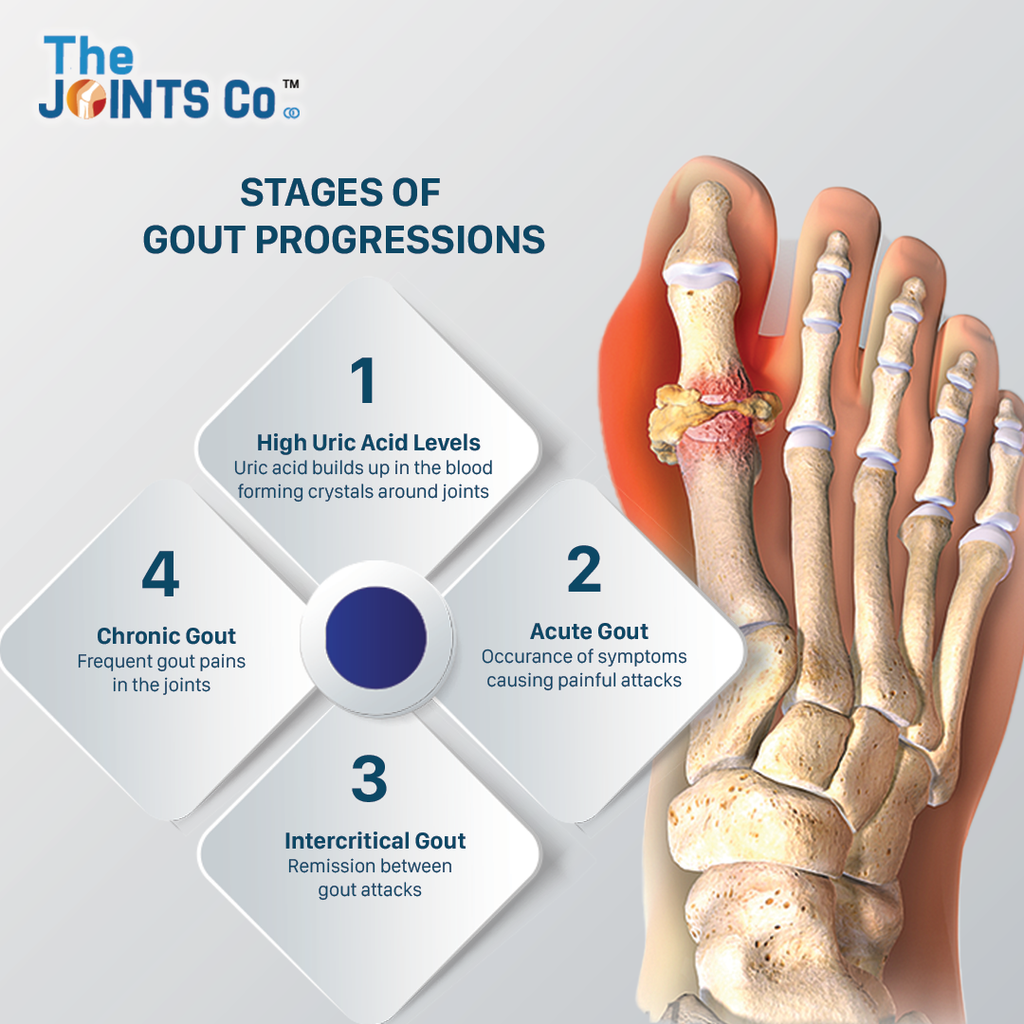 The Joints Co Gout Ease Plus for Uric Acid Issues – Nutrisage India